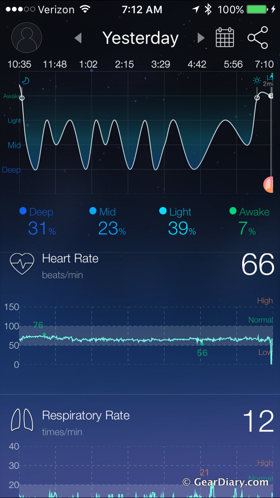 The Nox Smart Sleep System Holistically Monitors and Improves Your ...